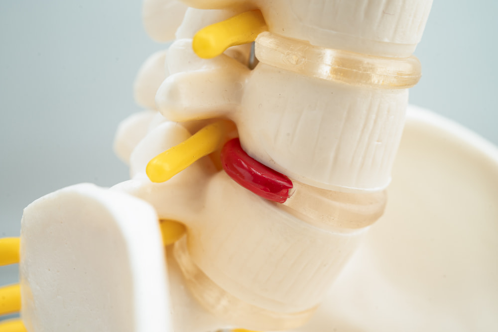 Diagnostic Facet Injections – Palm Valley Pain Management
